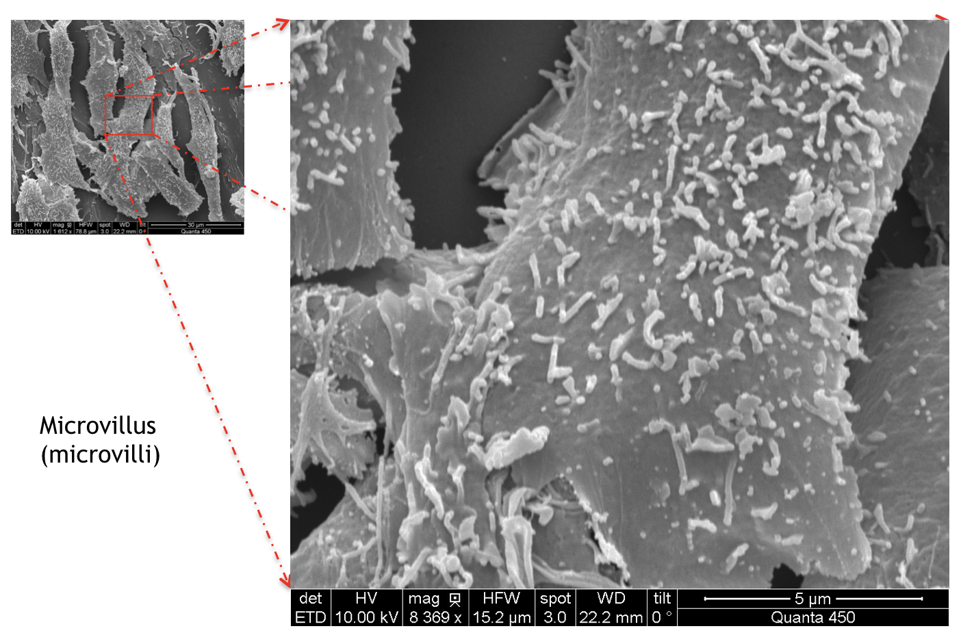 Solved Identify structures in the EM micrographs Match the | Chegg.com