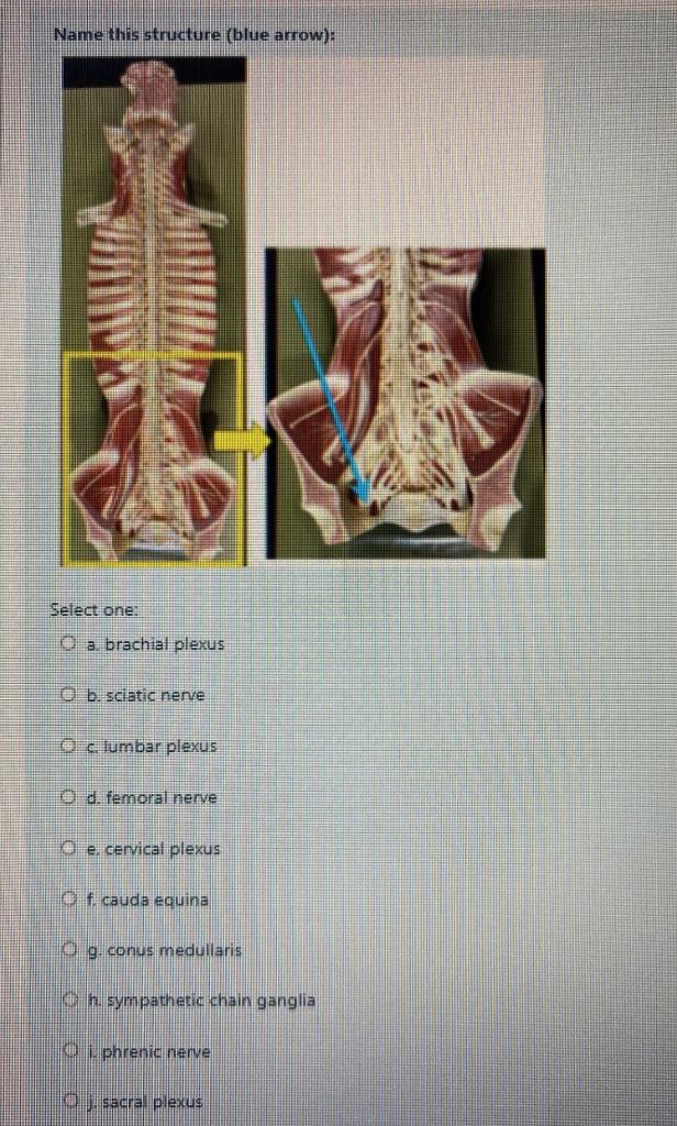 Solved Name this structure (blue arrow): Select one: a | Chegg.com