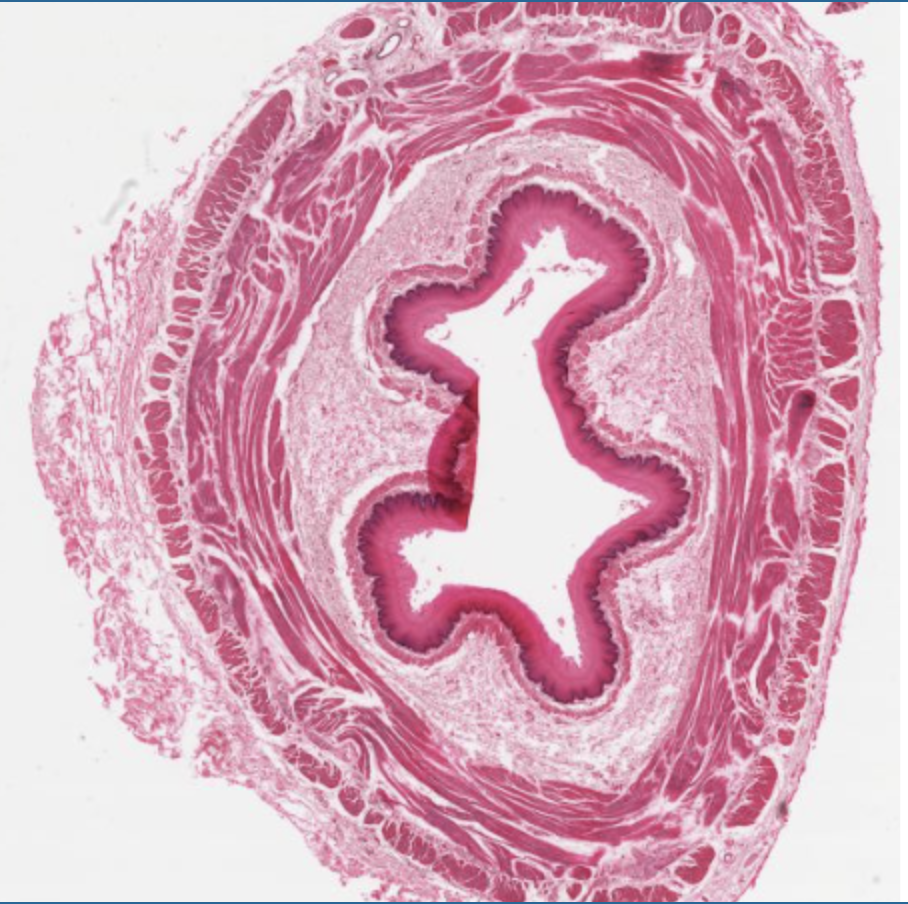 Solved need helping in labeling the following (this is an | Chegg.com