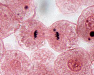 Solved Your lab partner mixed up a series of microscope | Chegg.com