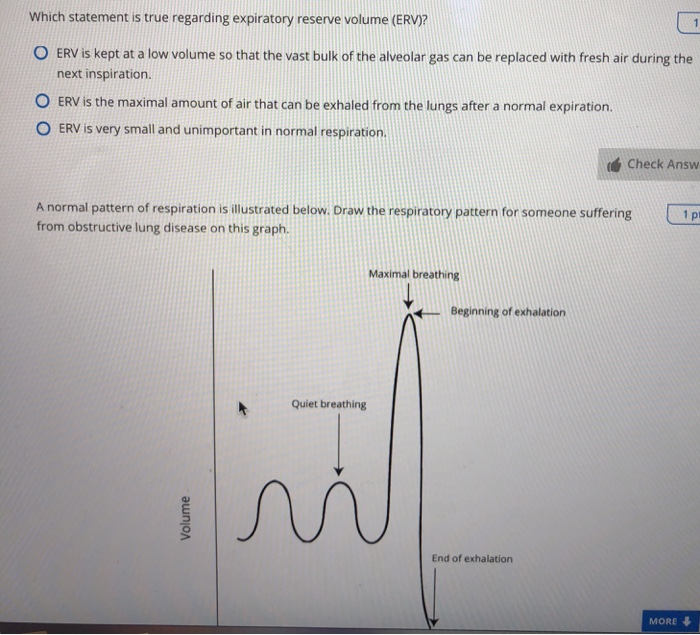 Solved A normal pattern of respiration is illustrated below. | Chegg.com