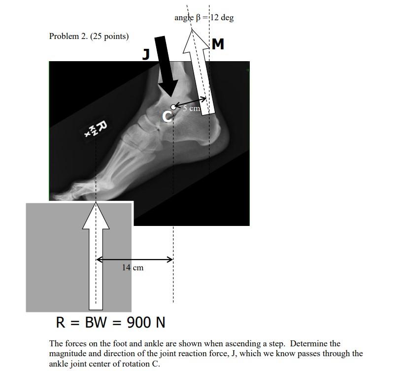 Solved The forces on the foot and ankle are shown when | Chegg.com