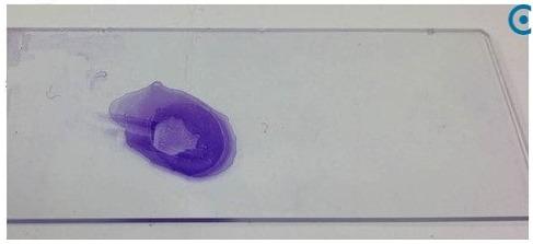 Once you've prepared your simple stain slide, it will | Chegg.com