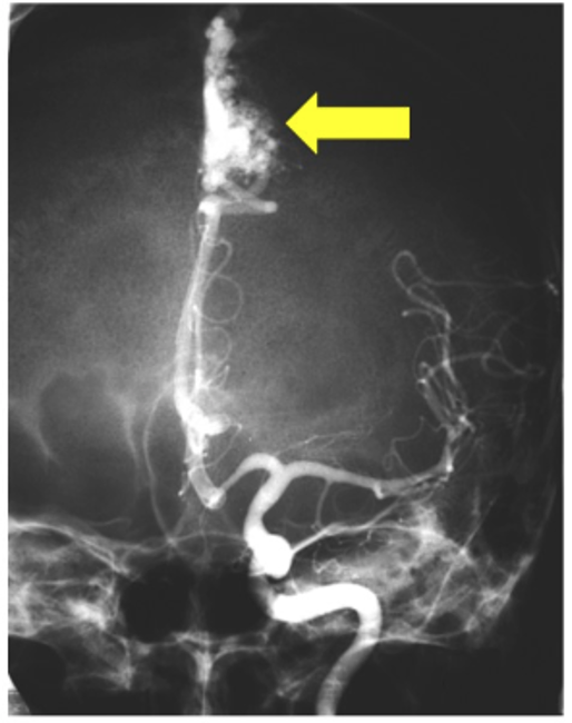 Solved Hello, I am wondering if the yellow arrow is | Chegg.com