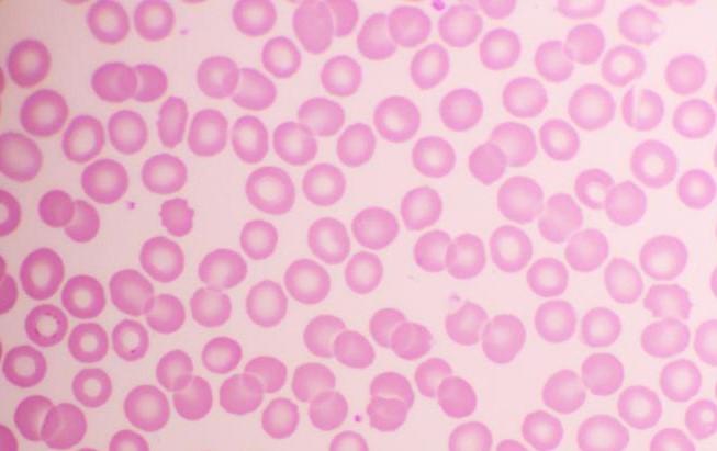 Solved Matlab Only Matlab Pls Count The Cells In The 