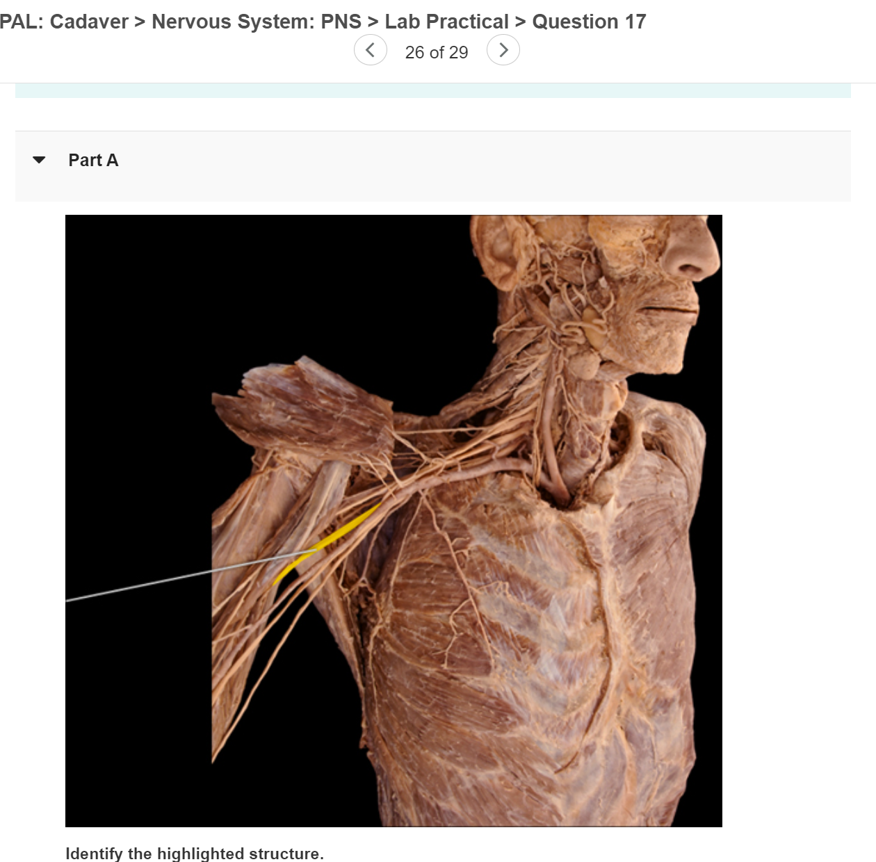 Solved Pal Cadaver Nervous System Pns Lab Practical