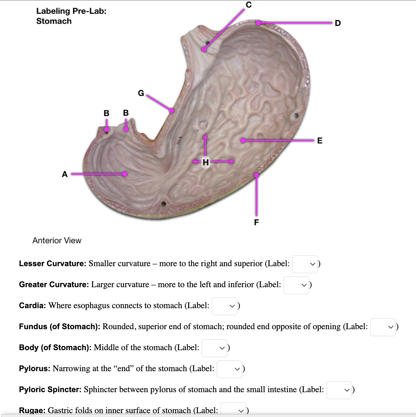 Solved Anterior View Lesser Curvature: Smaller curvature - | Chegg.com