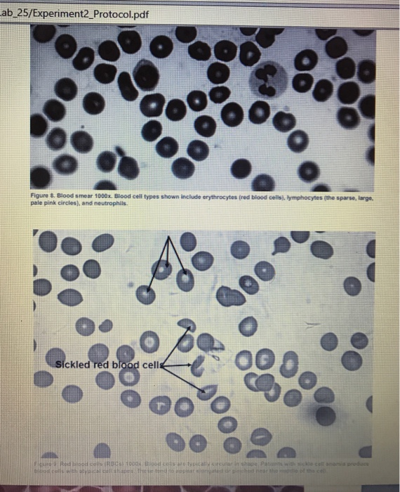 Solved Examine digital slide of blood in figure 7-9 then, | Chegg.com
