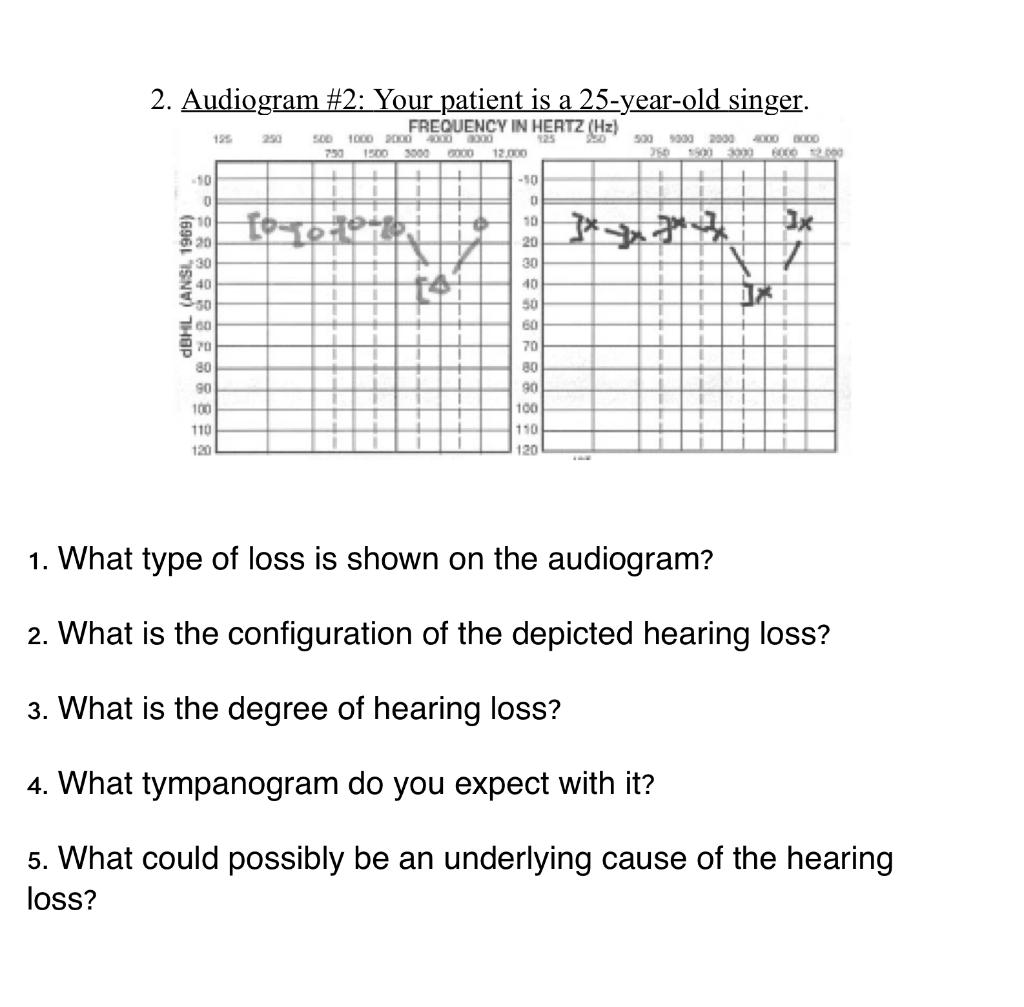 Solved 2. Audiogram #2: Your patient is a 25-year-old | Chegg.com