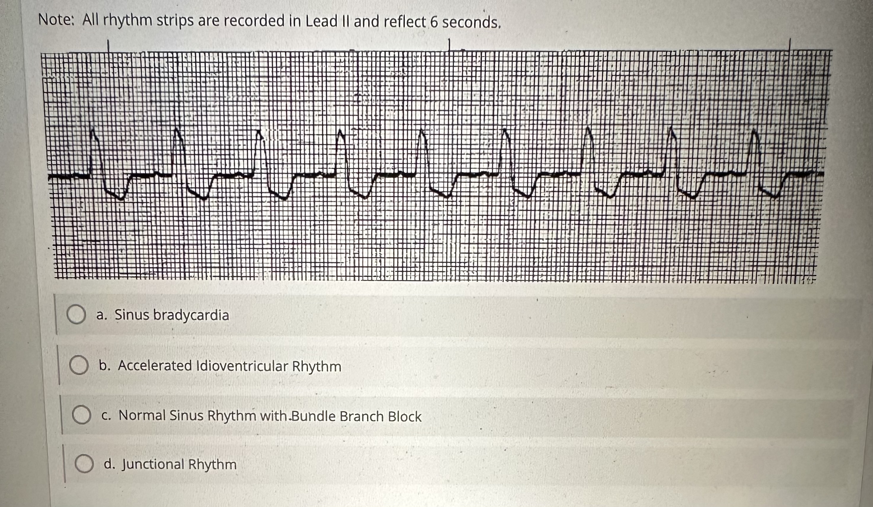 Solved Note: All rhythm strips are recorded in Lead II and | Chegg.com