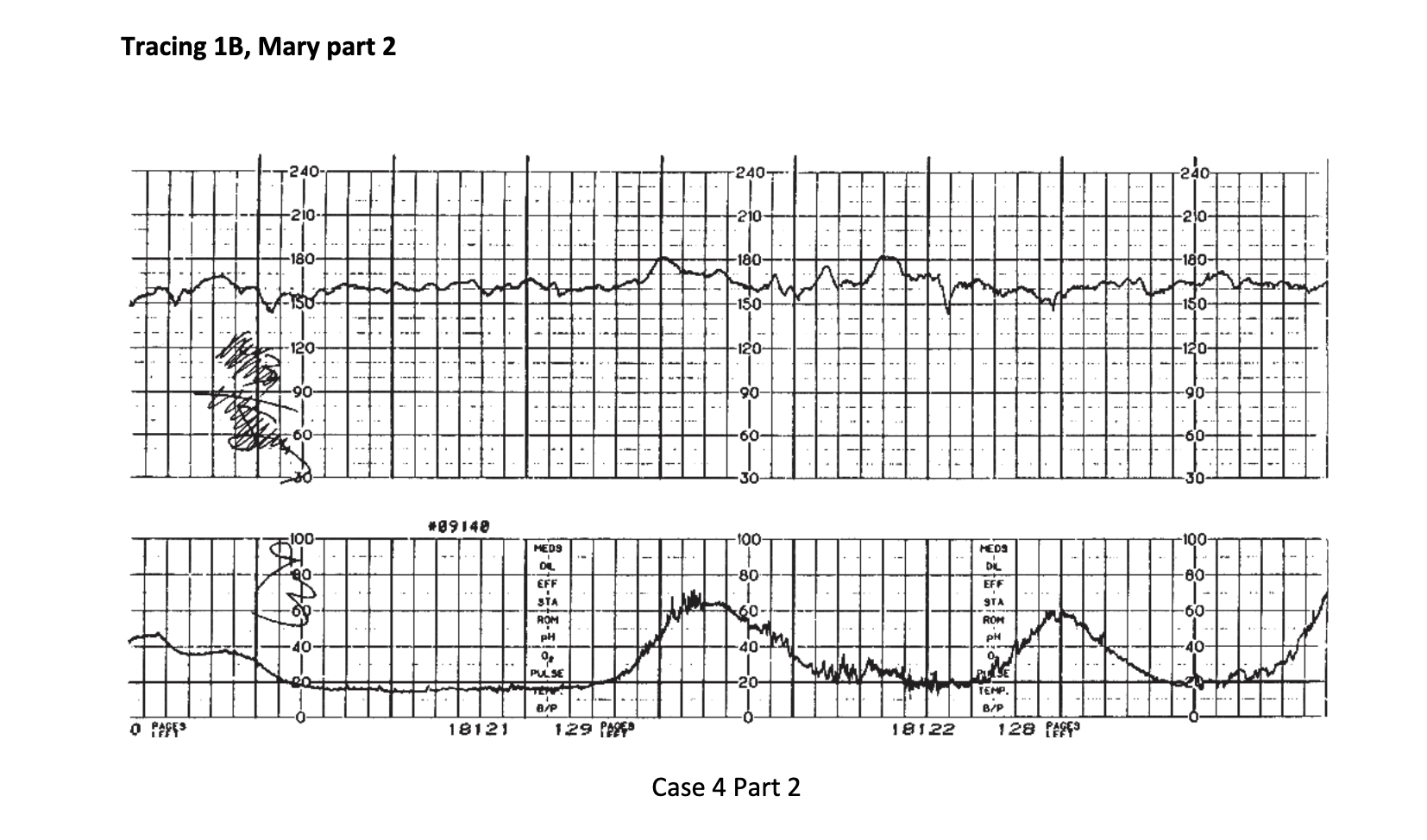 Solved What is the nursing interpretation of tracing 1B | Chegg.com