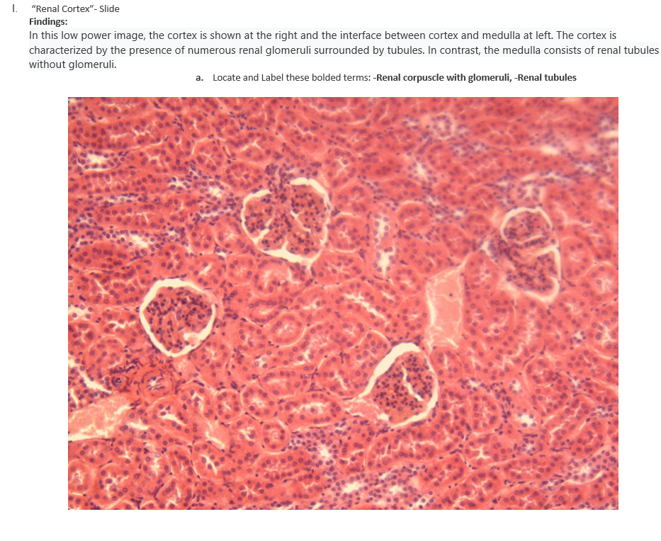 Labeled Kidney Slide Renal Tubules