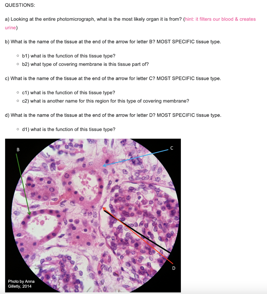 a) Looking at the entire photomicrograph, what is the | Chegg.com