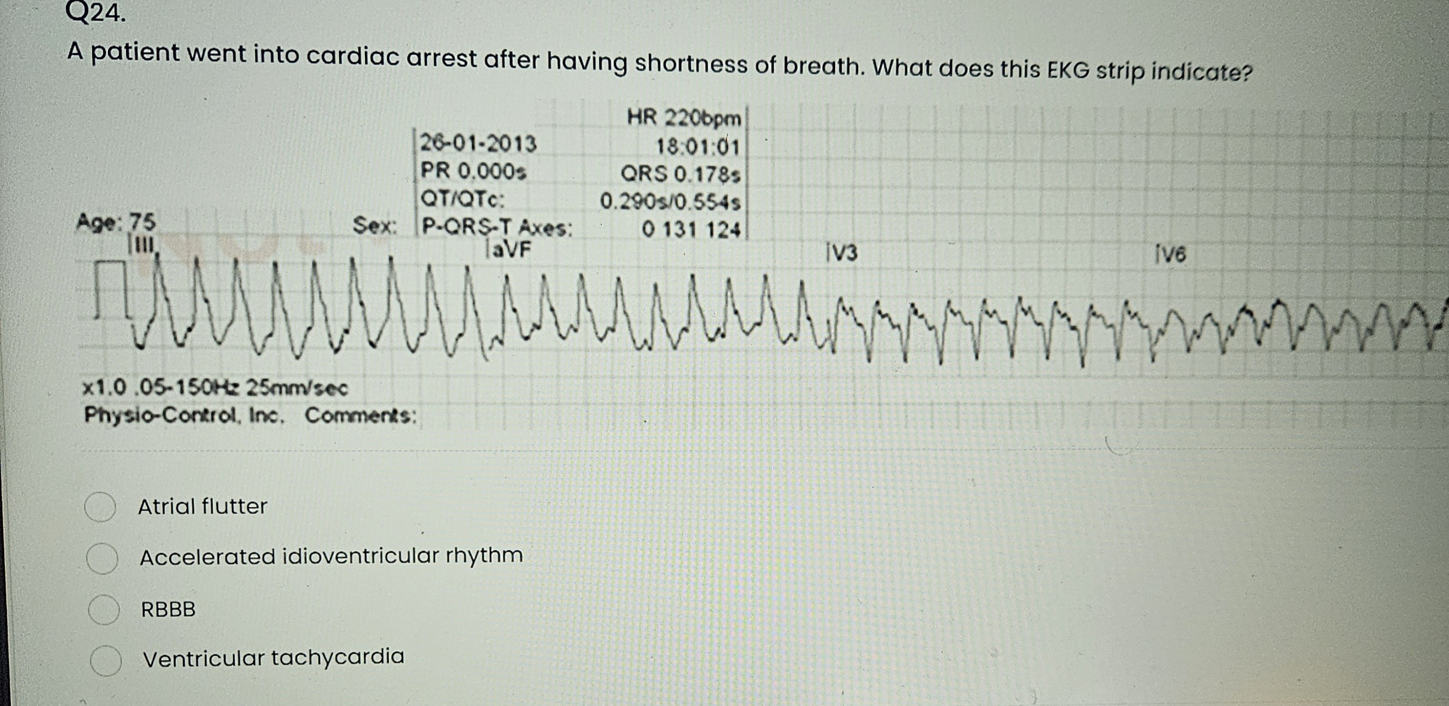 Solved Q24.A patient went into cardiac arrest after having | Chegg.com