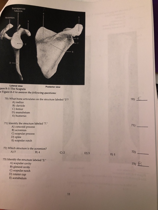 Solved Acromion Lateral view Posterior view ure 8-1 The | Chegg.com