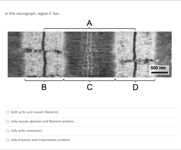 Solved In this micrograph region D represents: 500 nm B С a | Chegg.com