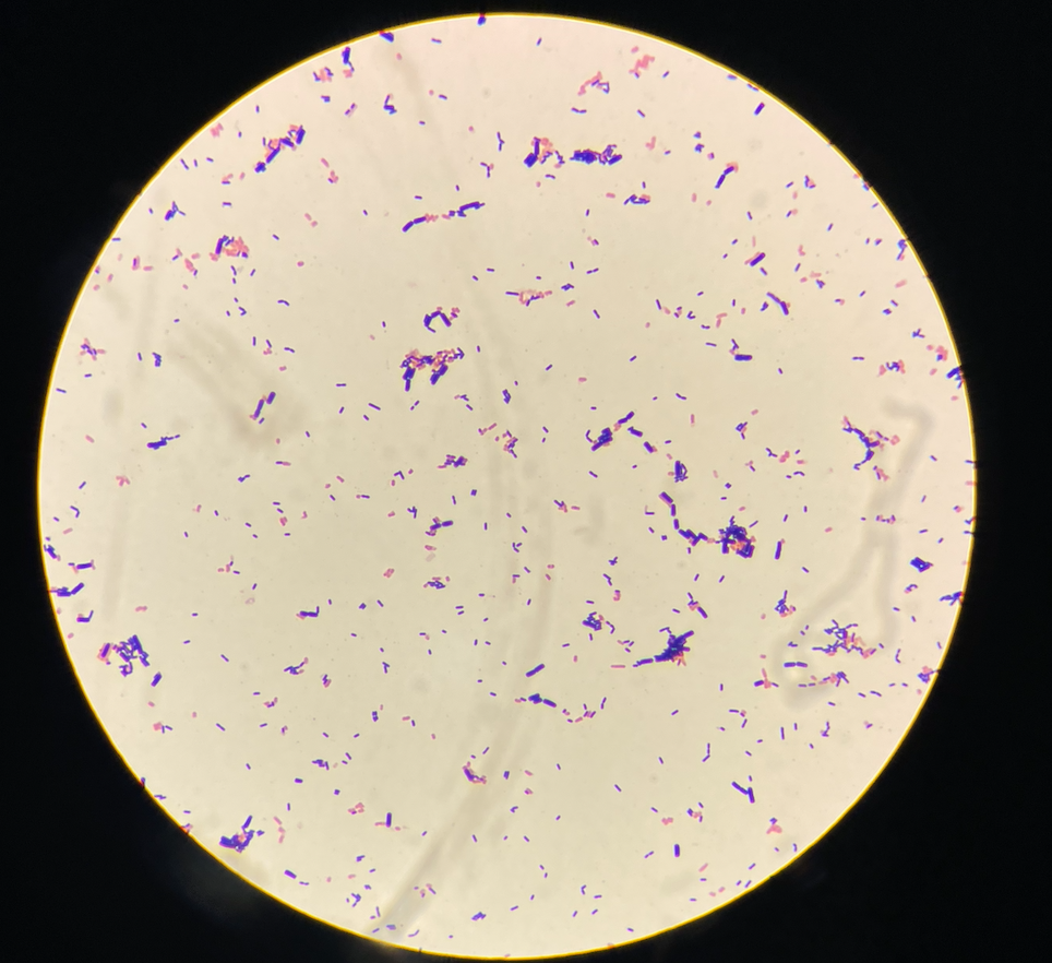 Solved Identify the bacteria from the image. Explain your | Chegg.com