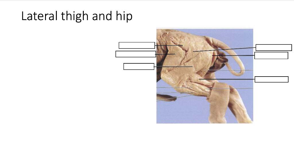 Solved Lateral thigh and hip | Chegg.com