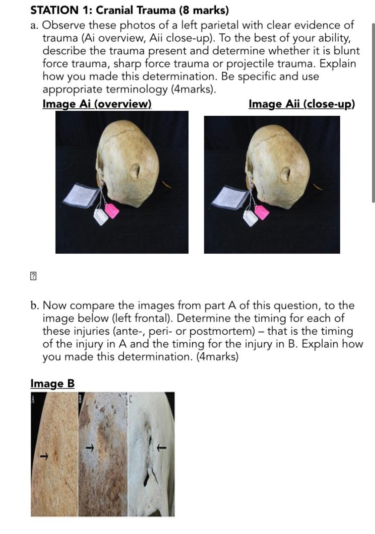 STATION 1: Cranial Trauma (8 marks) a. Observe these | Chegg.com