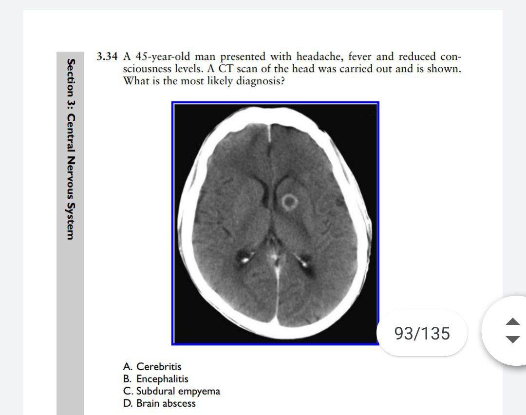 Solved 3.34 A 45-year-old man presented with headache, fever | Chegg.com