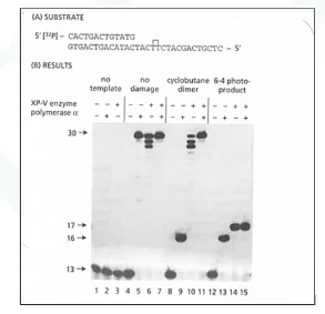 Solved Humans with the rare genetic disease Xeroderma | Chegg.com