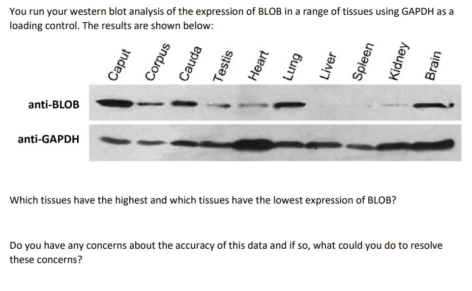 You run your western blot analysis of the expression | Chegg.com