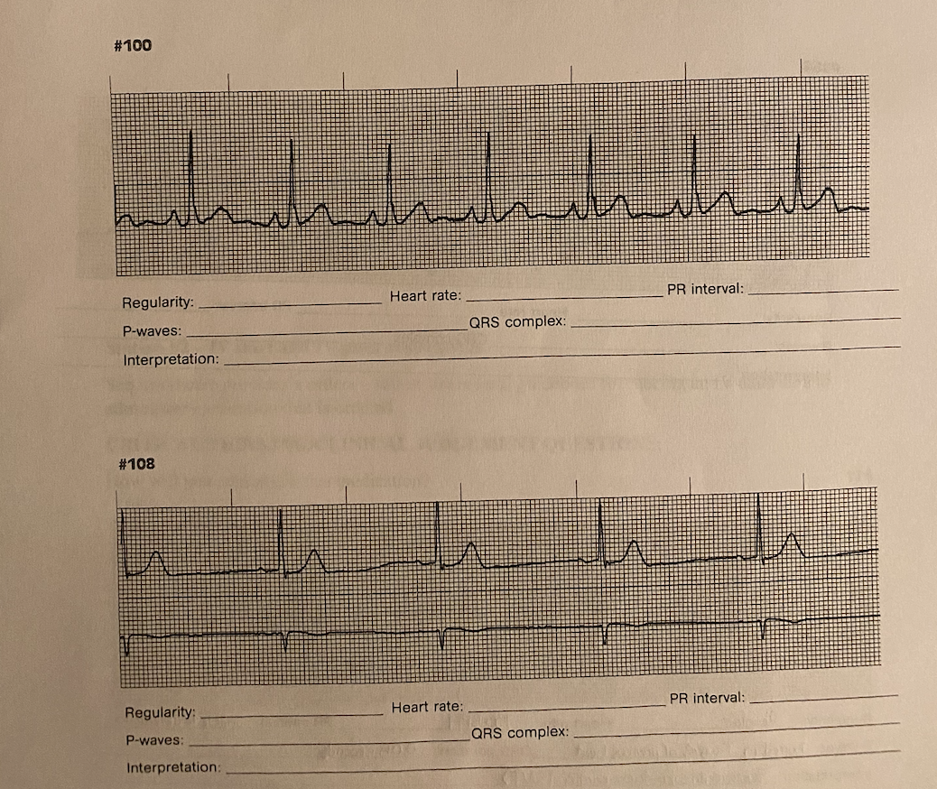 Solved Regularity: Heart rate: PR interval: P-waves: QRS | Chegg.com