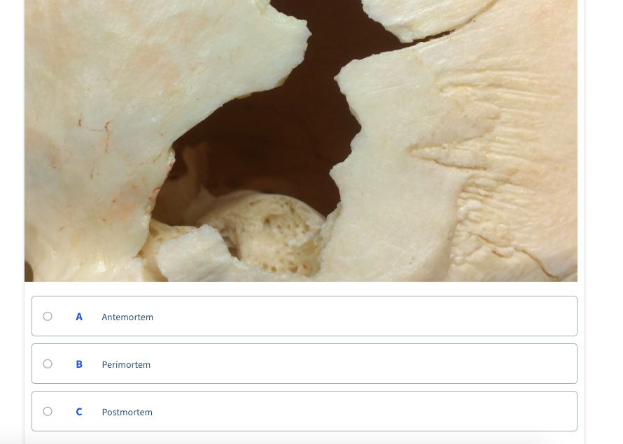 Solved Practice 1 Describe the timing of this gunshot wound | Chegg.com