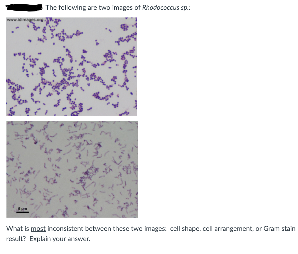 Solved The following are two images of Rhodococcus sp.: | Chegg.com