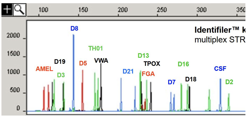Solved An image of a CODIS DNA profile is shown below. The | Chegg.com