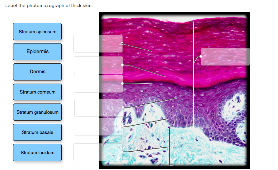 Solved Label the photomicrograph of thick skin. Stratum | Chegg.com
