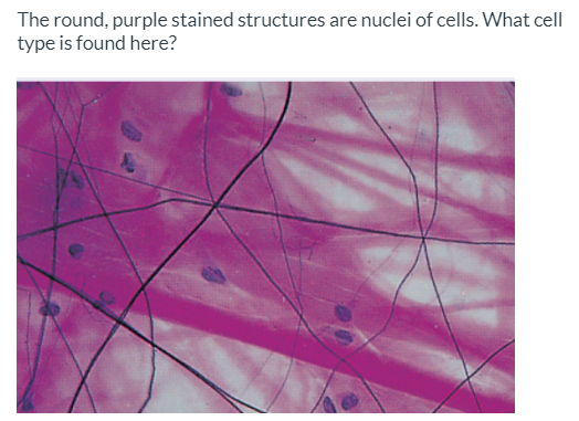 Solved The round, purple stained structures are nuclei of | Chegg.com