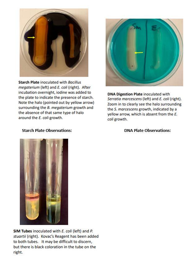 Solved A) SIM (left tube): H2S: Indole: Motility: SIM | Chegg.com