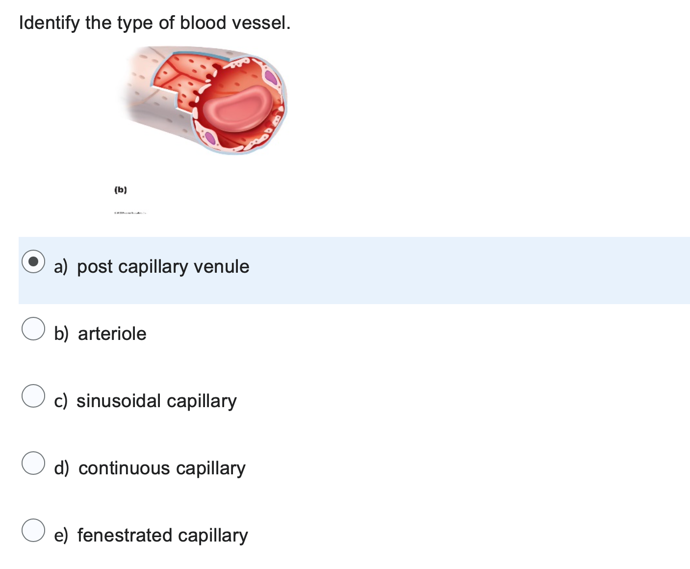 Solved Identify the type of blood vessel. (b) a) post | Chegg.com