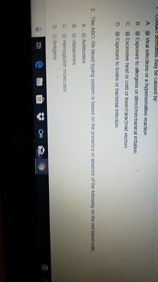 Solved EC demauts may be caused by A OViral infections or a | Chegg.com