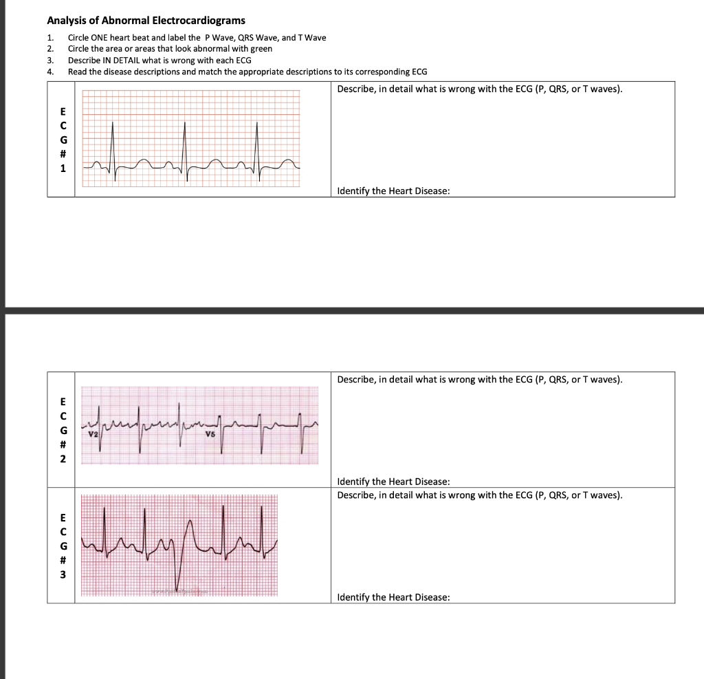 Solved Analysis of Abnormal Electrocardiograms 1. Circle ONE | Chegg.com