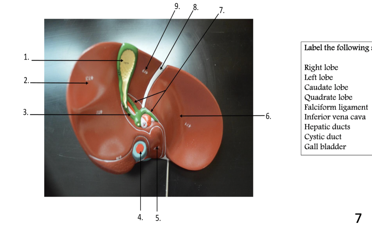 Solved Label the following structures: Appendix | Chegg.com