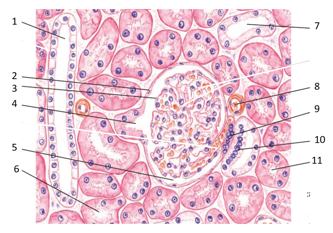 Solved Urinary System:- Identify the organ/tissue and label | Chegg.com