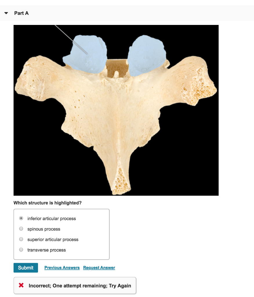 Solved Part A Which structure is highlighted? inferior | Chegg.com