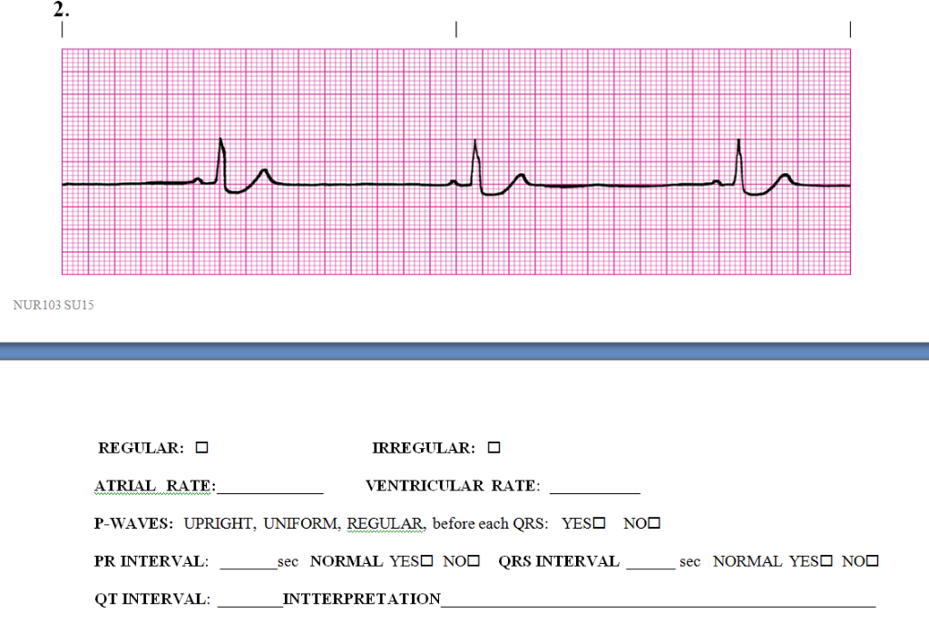Solved 2. NUR103 SU15 REGULAR: ATRIAL RATE: P-WAVES: | Chegg.com