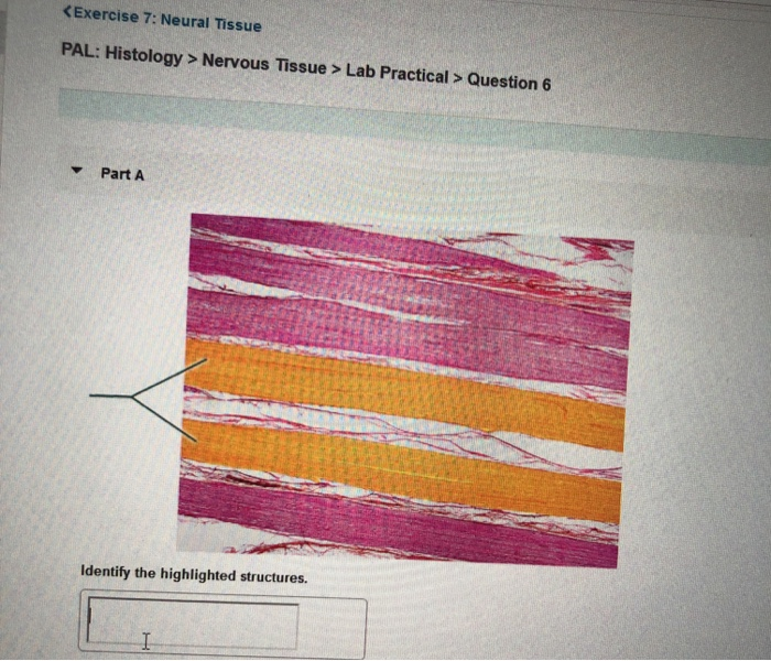Solved KExercise 7: Neural Tissue PAL: Histology > Nervous | Chegg.com