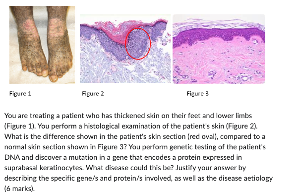 Solved Figure 1 You are treating a patient who has thickened | Chegg.com