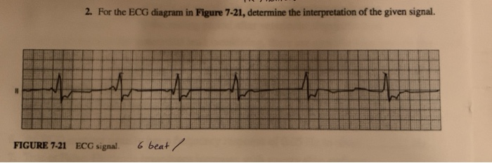 Solved 2. For the ECG diagram in Figure 7-21, determine the | Chegg.com