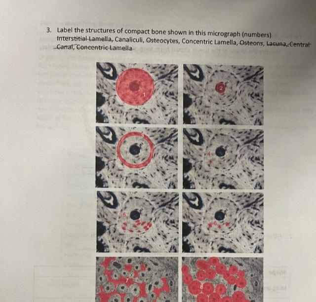 Solved 3. Label the structures of compact bone shown in this | Chegg.com