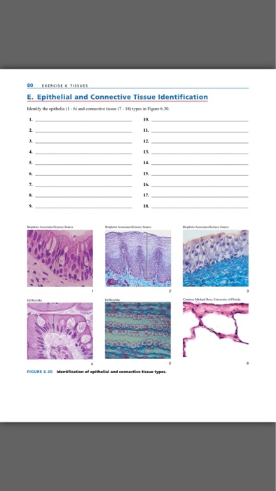 E. Epithelial and Connective Tissue Identification | Chegg.com E. Epithelial and Connective Tissue Identification | Chegg.com