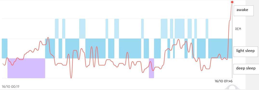 Solved This is the graph of sleep cycle of the woman who use | Chegg.com