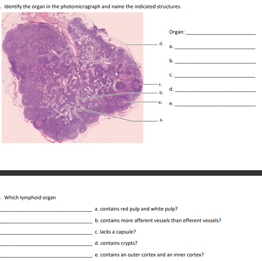 Identify the organ in the photomicrograph and name | Chegg.com