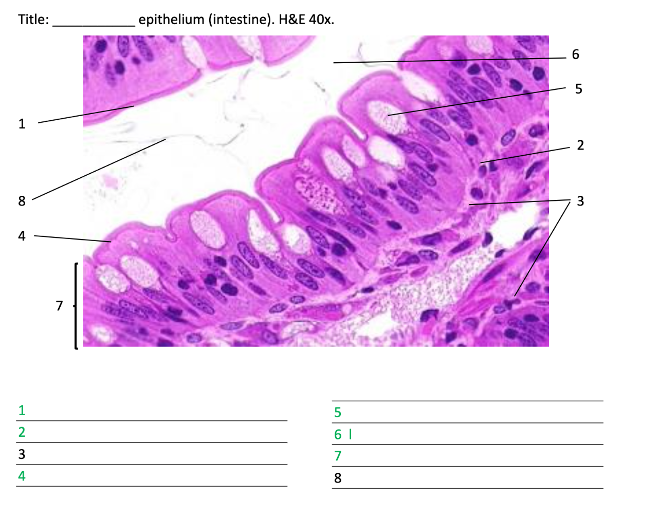 Solved Title: epithelium (intestine). H&E 40x. 6 5 1 2 8 3 4 | Chegg.com