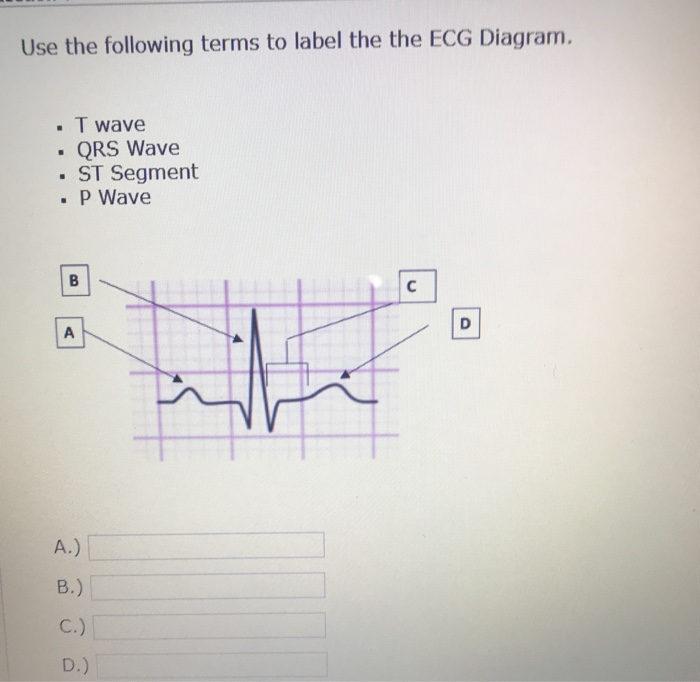 Solved Use the following terms to label the the ECG Diagram. | Chegg.com
