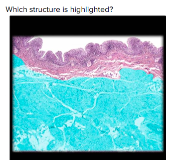 Solved Which structure is highlighted? Which structure is | Chegg.com